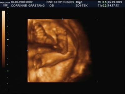 A Record of My Pregnancy: 25 Weeks, 3 Days - 4D Scan